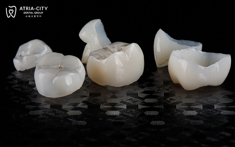 Caring for Your Dental Crown: Maintenance Tips for Longevity | Atria ...